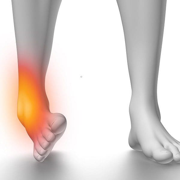 Lateral Ankle Sprain Rehabilitation and Exercise - LIVEWELL Health